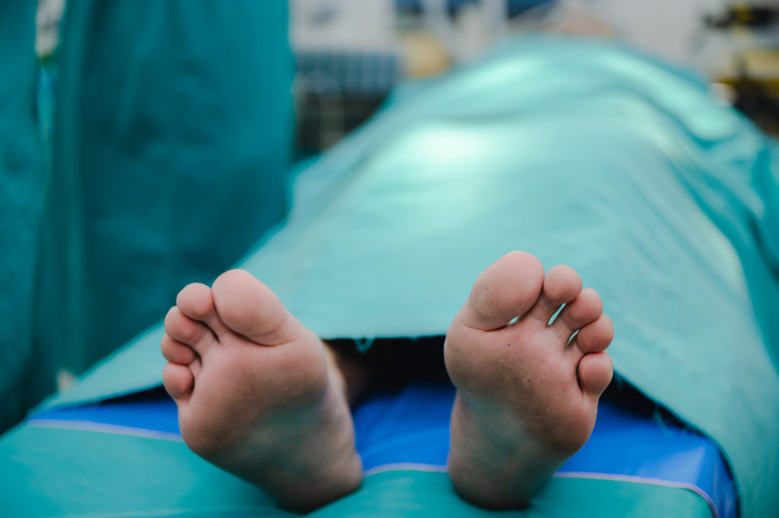 How Embalming Fluid Can Impact an Autopsy - Direct Cremate